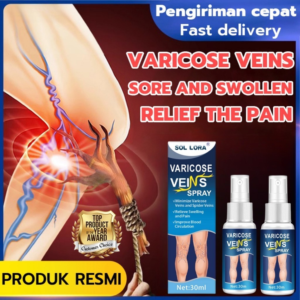 Jual SOLLORA Varicose vein spray Varises Cream Obat Varises Salep ...