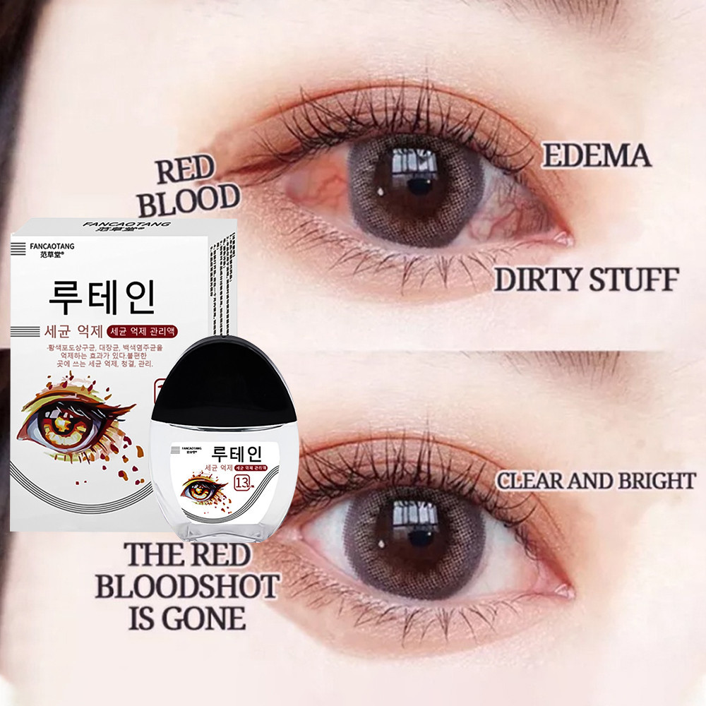 Jual Obat tetes mata obat mata minus obat mata katarak 13ml Pengobatan ...