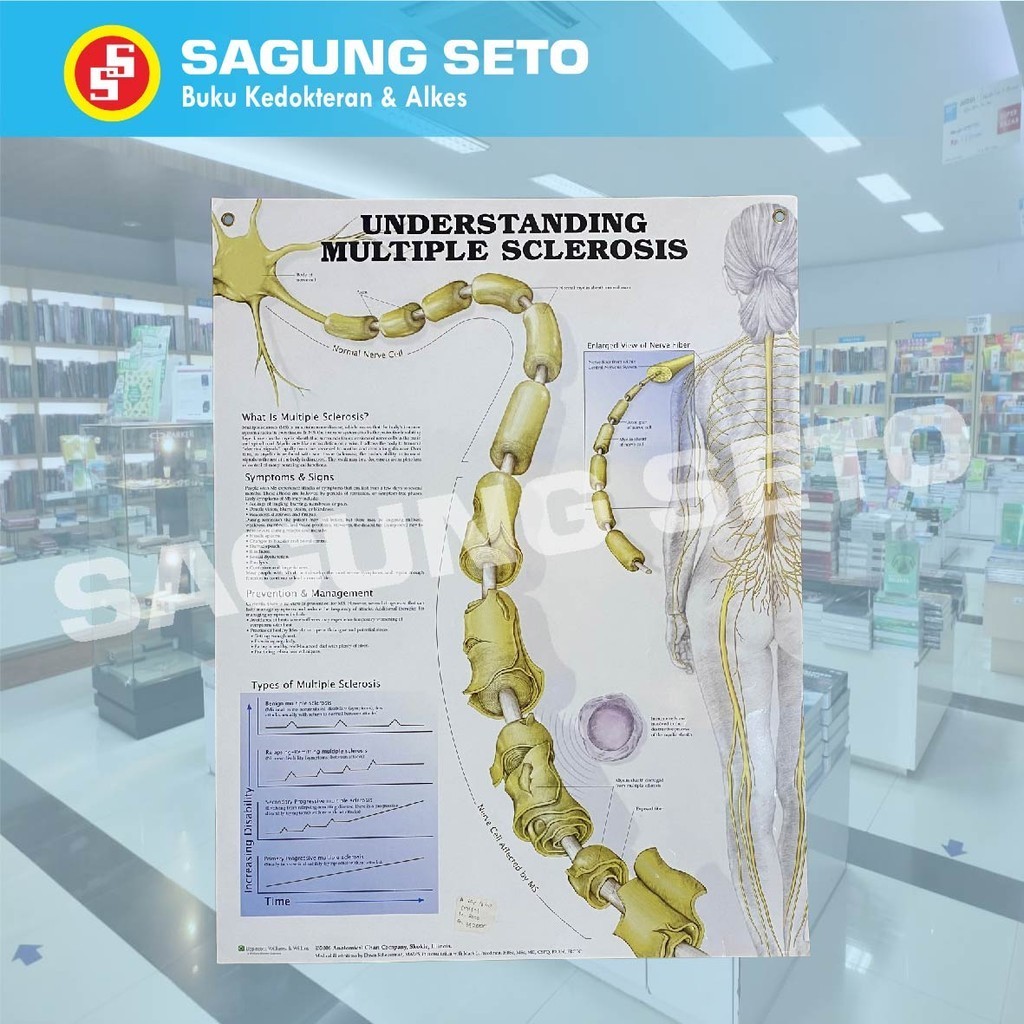 Jual POSTER UNDERSTANDING MULTIPLE SCLEROSIS LAMINATED 2D / POSTER ...