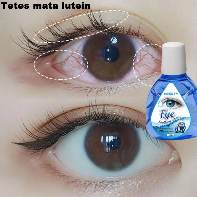 Jual Eye Drop Obat Tetes Mata Obat Mata Katarak Mata Kering Sakit Mata ...