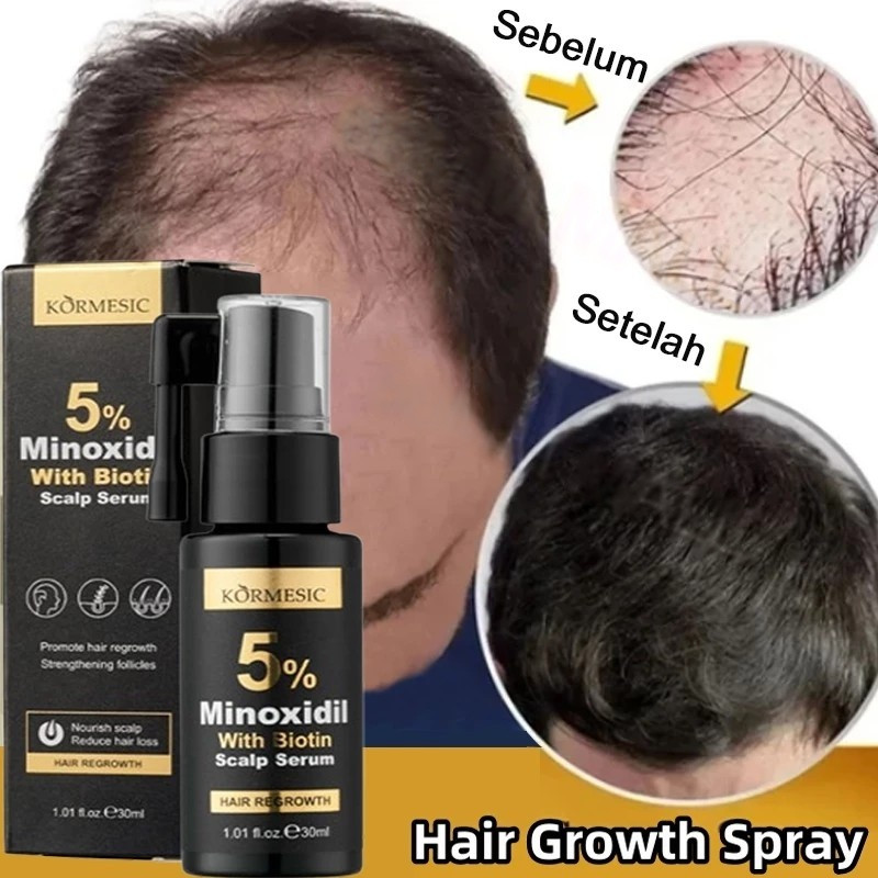 Jual Minoxidil Penumbuh Rambut serum Obat Penumbuh Rambut Botak Tipis ...