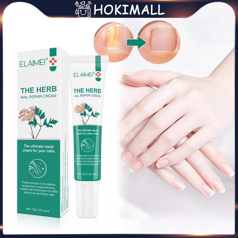 Jual Perawatan Jamur Kuku Obat Jamur Kuku Perawatan Kuku Rusak Repair ...
