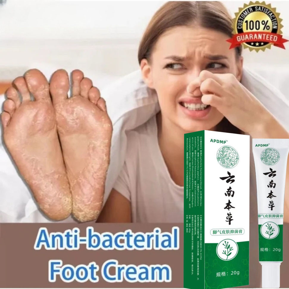 Jual Beriberi Antibacterial Cream 20g Menghilangkan Jamur Tinea Pedis ...