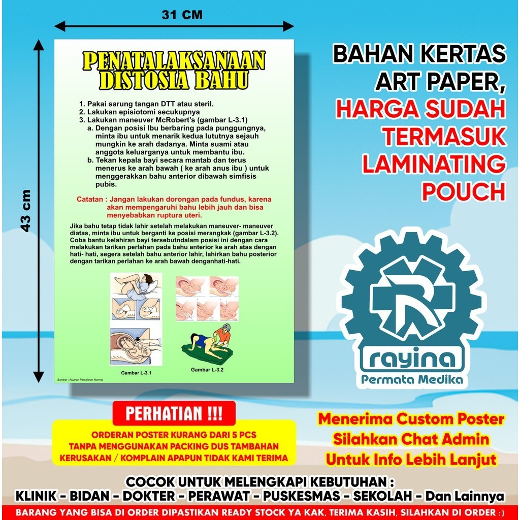 Jual Poster Penatalaksanaan Distosia Bahu | Shopee Indonesia
