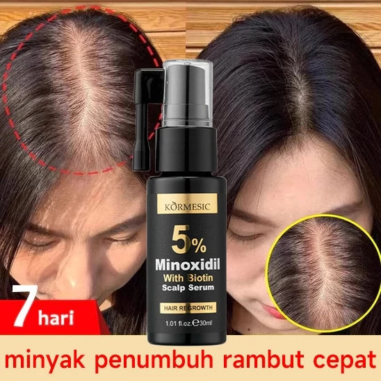 Jual 5% Minoxidil Serum penumbuh rambut Obat penumbuh rambut Penumbuh ...