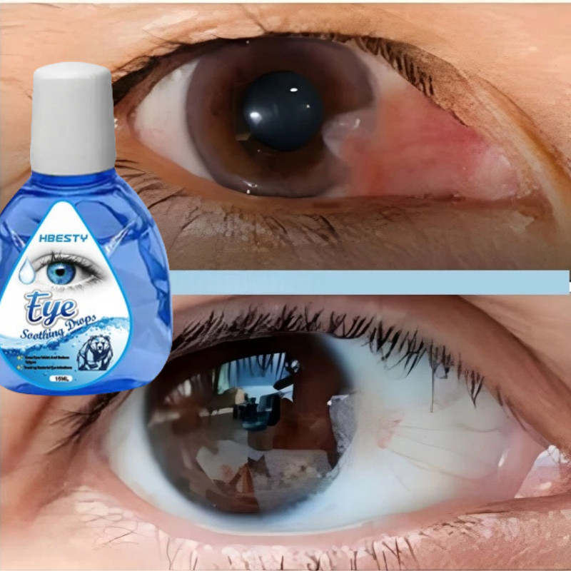 Jual Eye Drop Obat Tetes Mata Obat Mata Katarak Mata Kering Sakit Mata ...