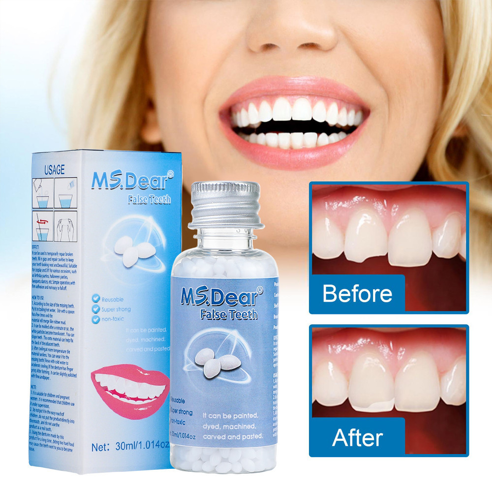 Jual PREORDER 30ml Resin Temporary Tooth Repair Teeth Gaps False Teeth Solid Glue Denture ...