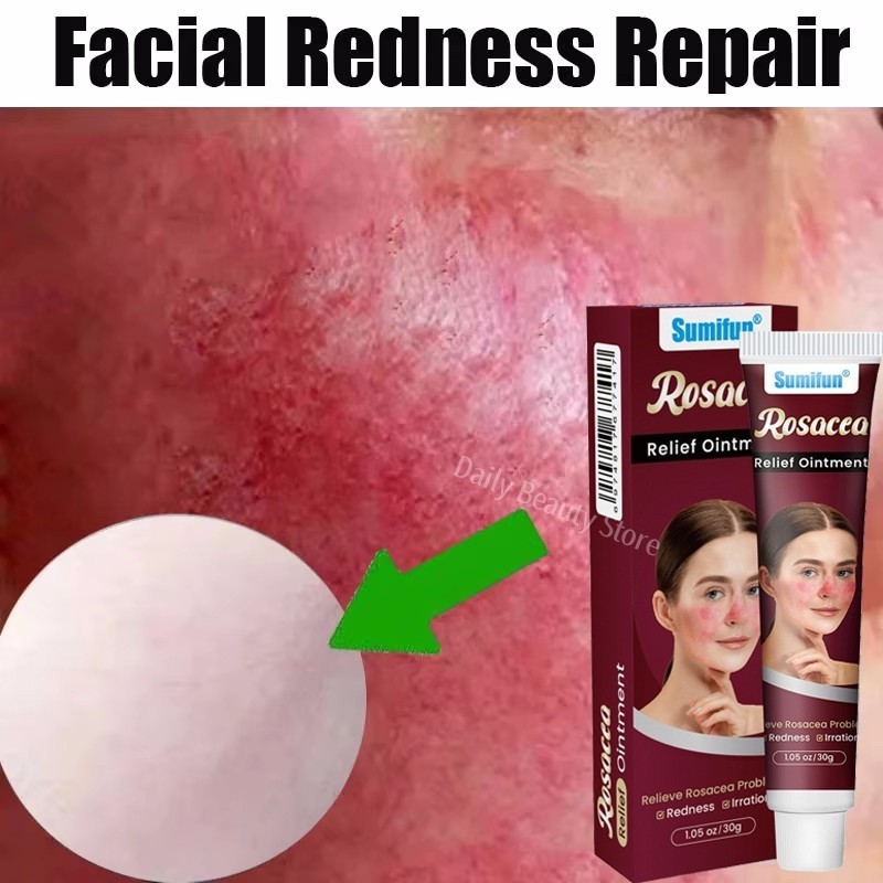 Jual Repair Facial Redness Cream Instant Spider Vein Remove Sensitive ...