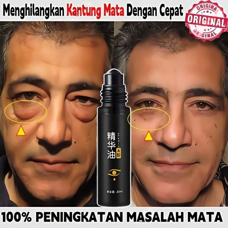 Jual Eye cream menghilangkan milia menghilangkan keriput di mata dan ...