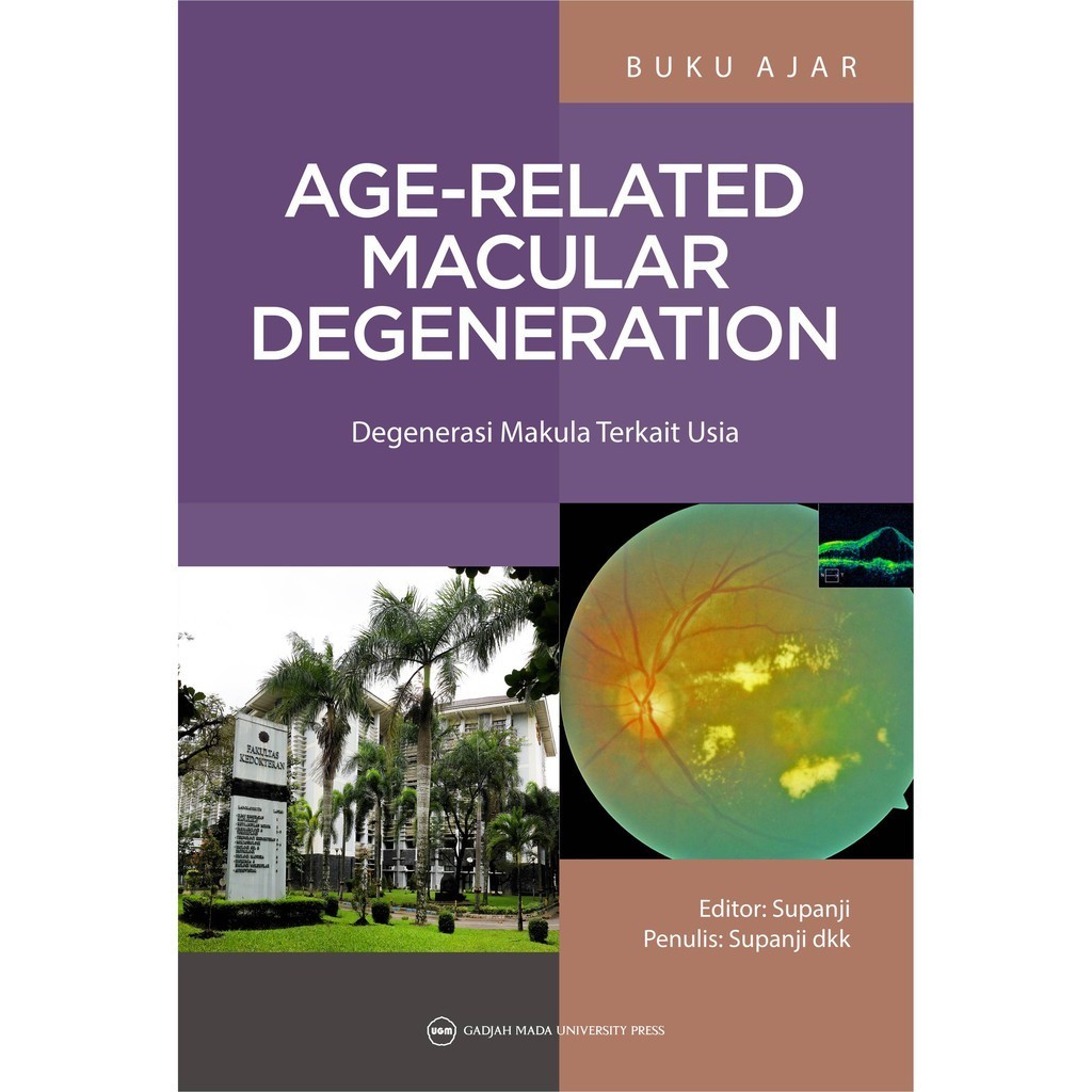 Jual Buku Ajar Age-Related Macular Degeneration: Degenerasi Makula ...