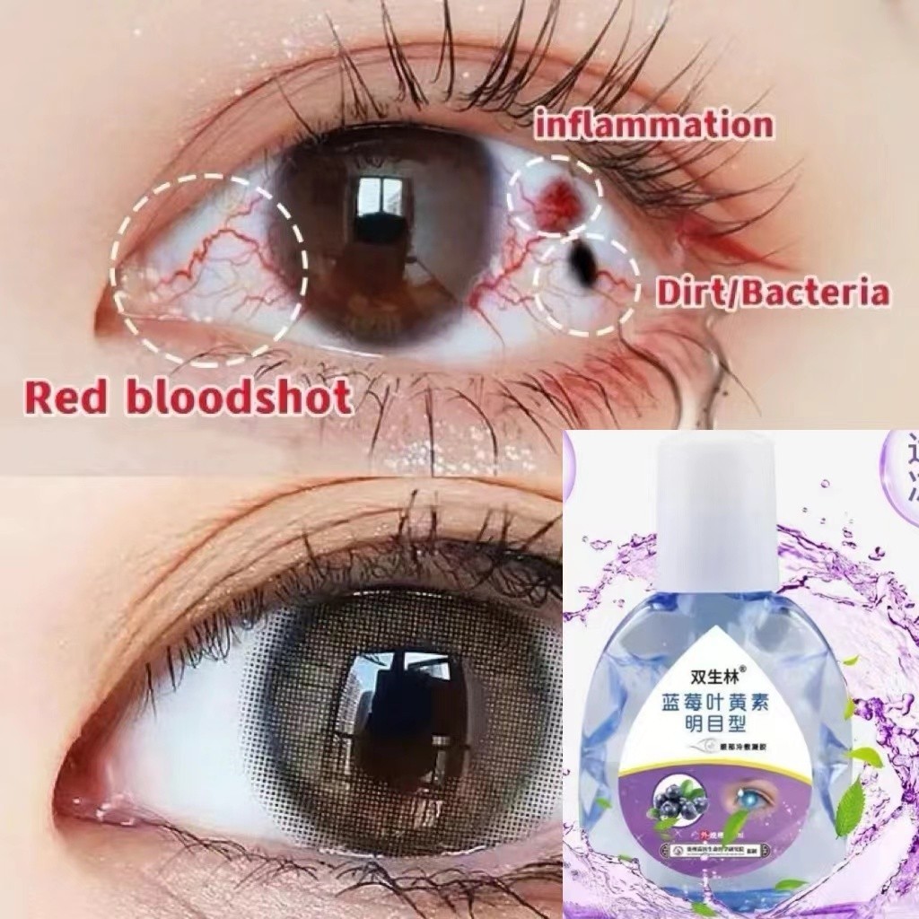 Jual Obat tetes mata Tetes Mata Herbal Tetes Mata Alami eye drop ...