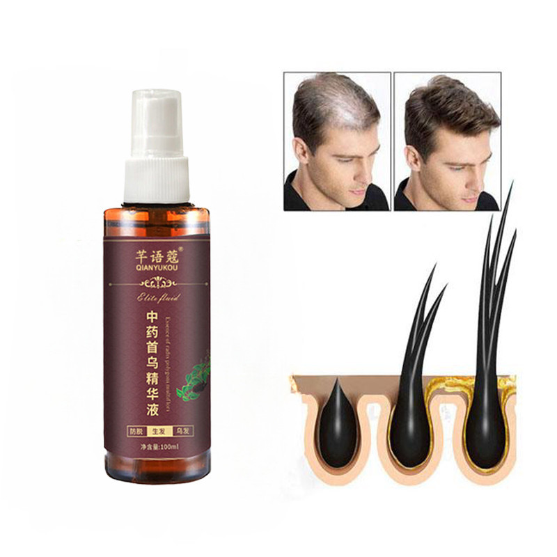 Jual Serum Penumbuh Rambut Anti Botak Penumbuh Rambut Botak Penyubur ...