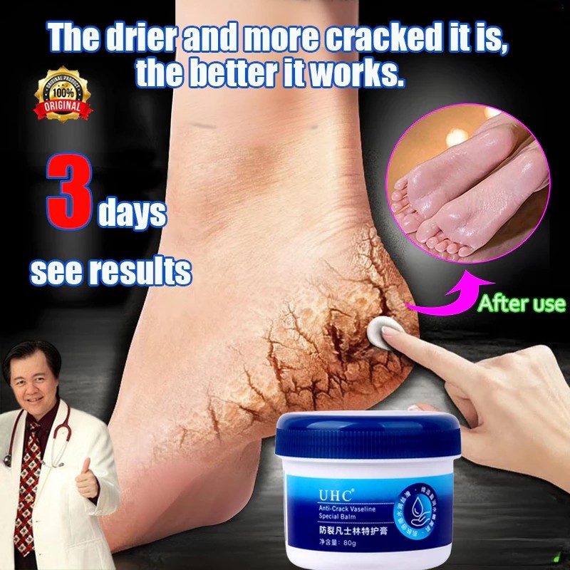Jual Vaseline cream kaki pecah dan kering Obat kaki pecah pecah 80g ...