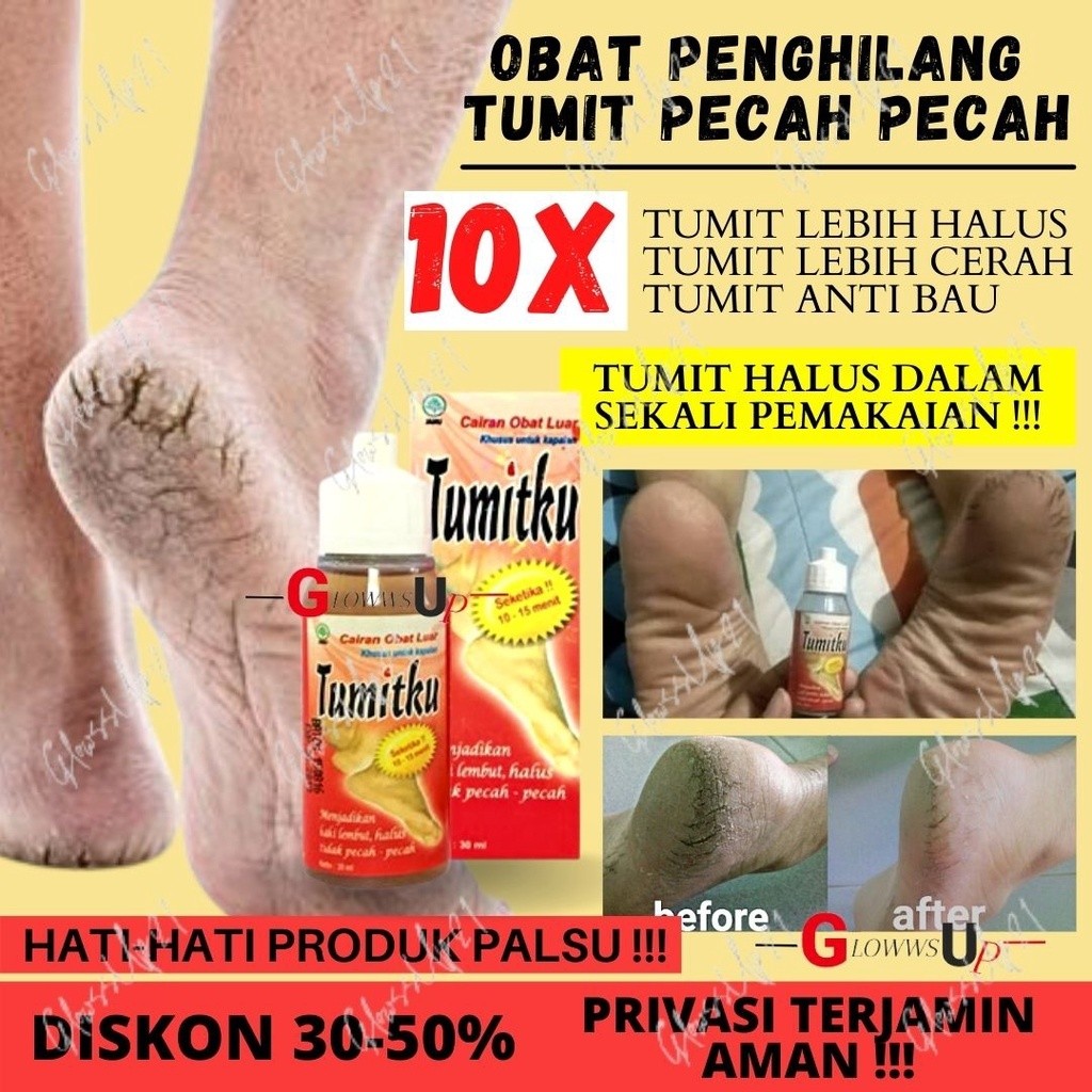 Jual TUMITKU OBAT KAKI PECAH TUMITKU 30ML OBAT HERBAL MENGATASI KAKI ...