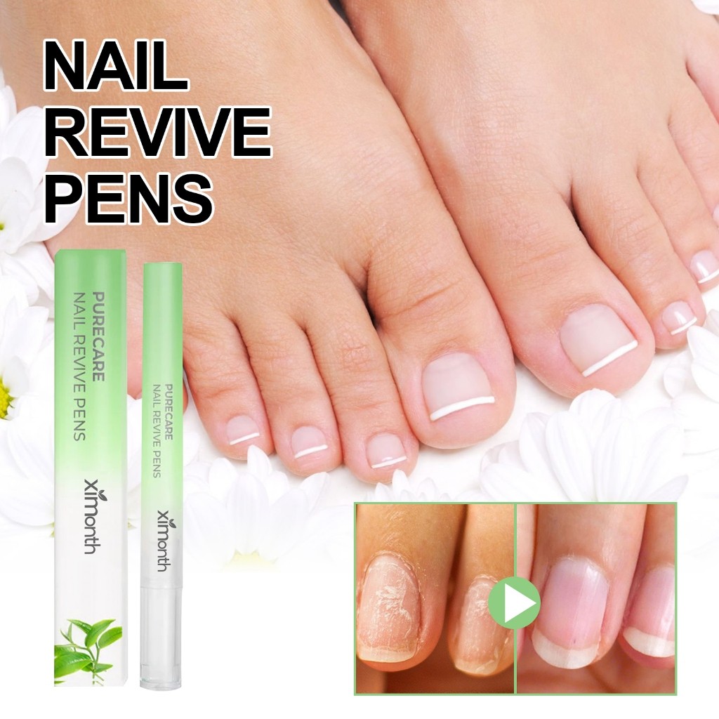Jual Ximonth Nail Repair Pen Pena Perbaikan Kuku Vitamin Kuku Mengkilap ...