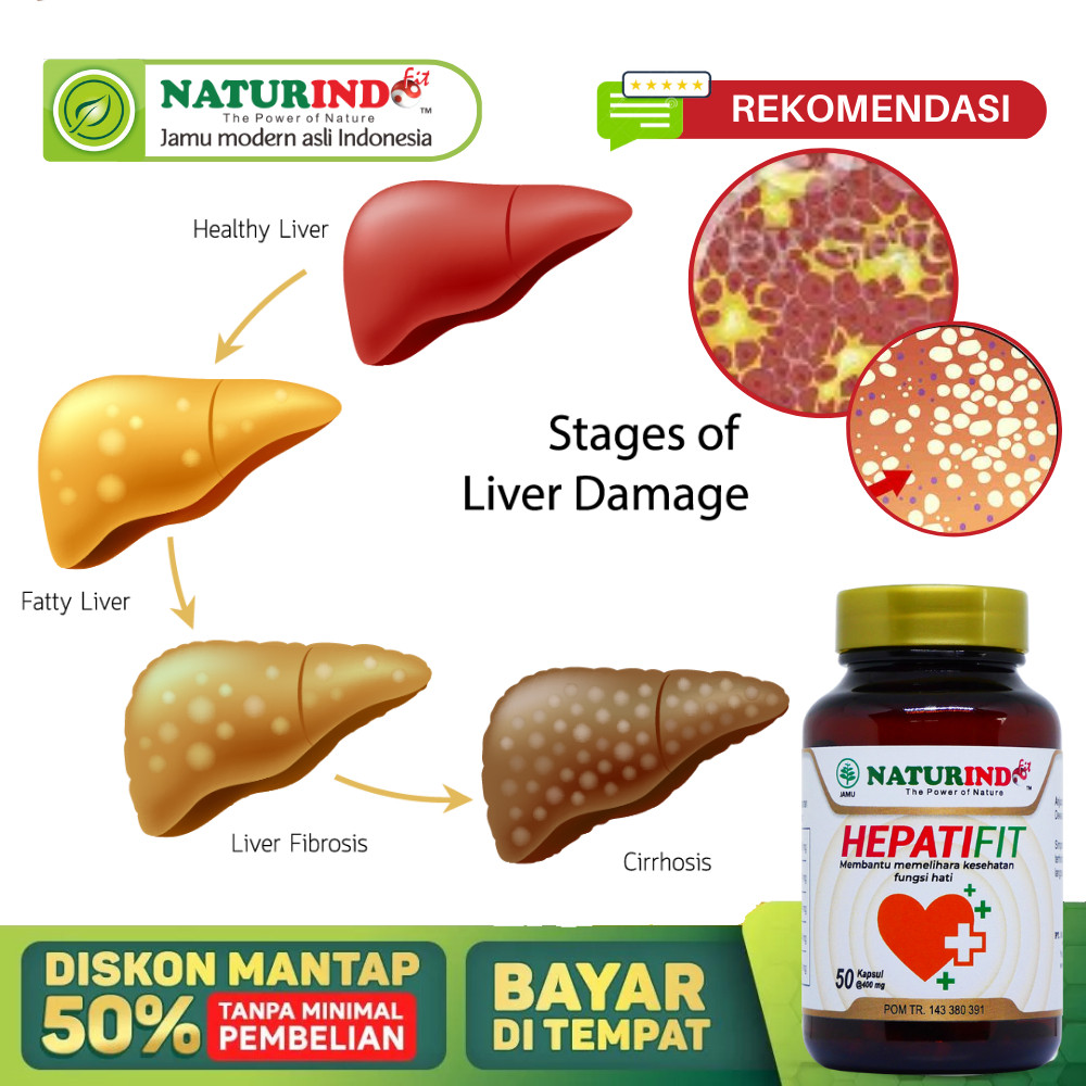 Jual Obat Liver Hati Paling Ampuh Penyakit Kuning Pelemakan Hati Fatty ...