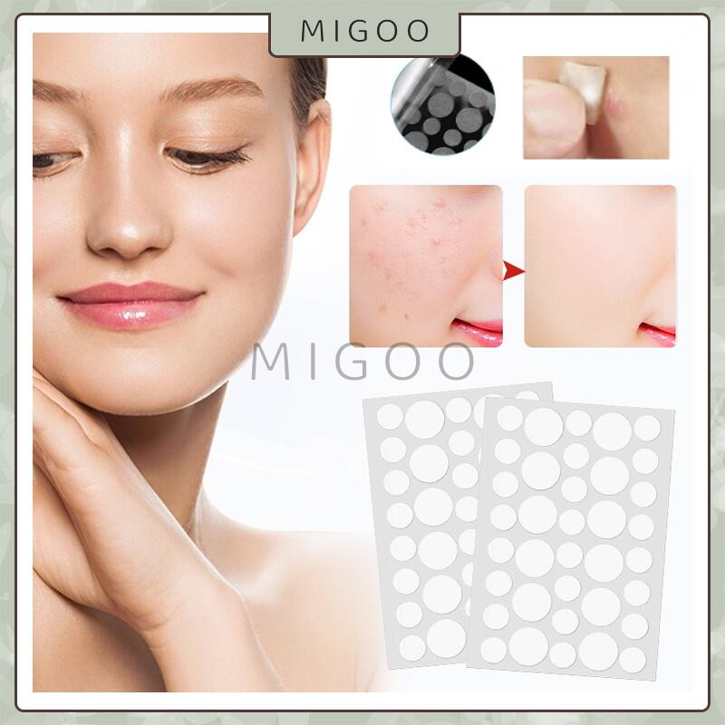 Jual Patch Penghilang Jerawat 36 Pcs / Sticker Penghilang Jerawat ...