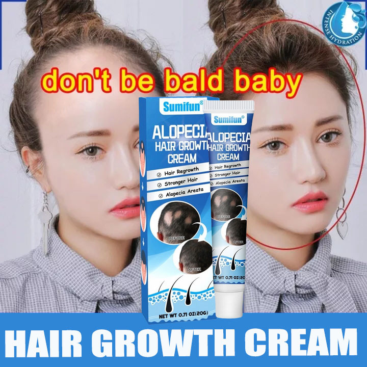 Jual Sumifun Obat Alopecia Areata, Rambut Pitak, Penumbuh Rambut Pitak ...