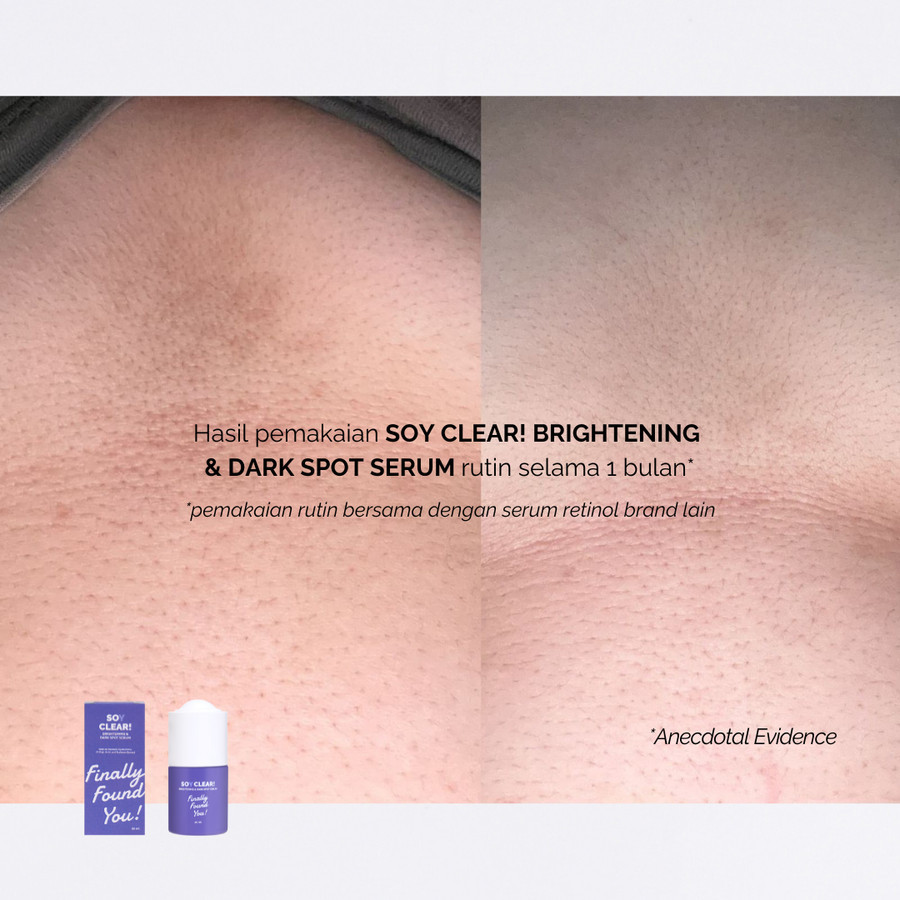 Jual Finally Found You! SOY CLEAR Brightening & Dark Spot Serum WAJAH ...