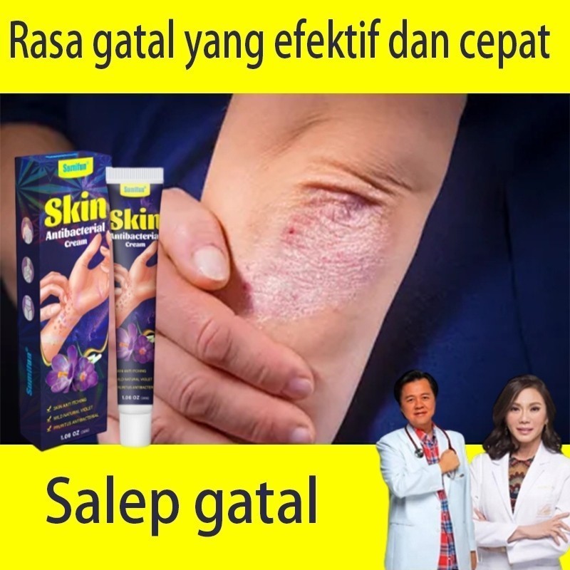 Jual Salep Anti Gatal Psoriasis Salep Anti Gatal Kutil Salep 20G Obat ...