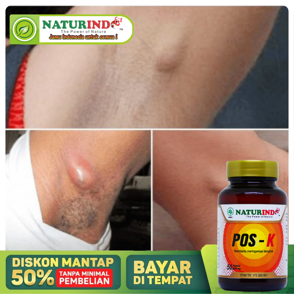 Jual Obat Benjolan di Ketiak Paling Ampuh, Obat Untuk Kelenjar Getah ...