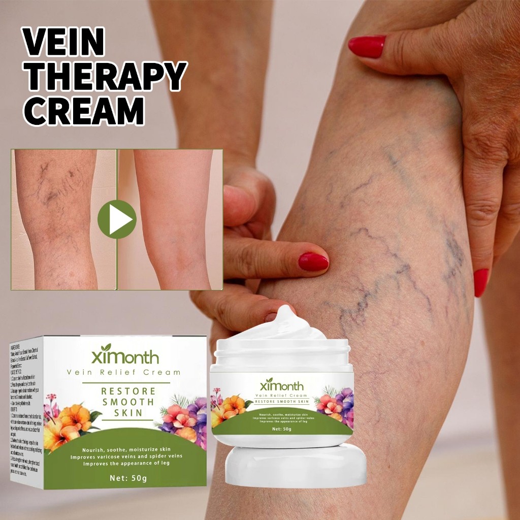 Jual XIMONTH Varicose Vein Removal Cream 50g Spider Vein Earthworm Leg ...