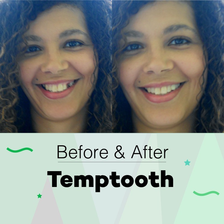 Jual PROMO!!! TEMPTOOTH 200 BUTIR MURAH ORIGINAL / TEMTOOTH / Gigi ...