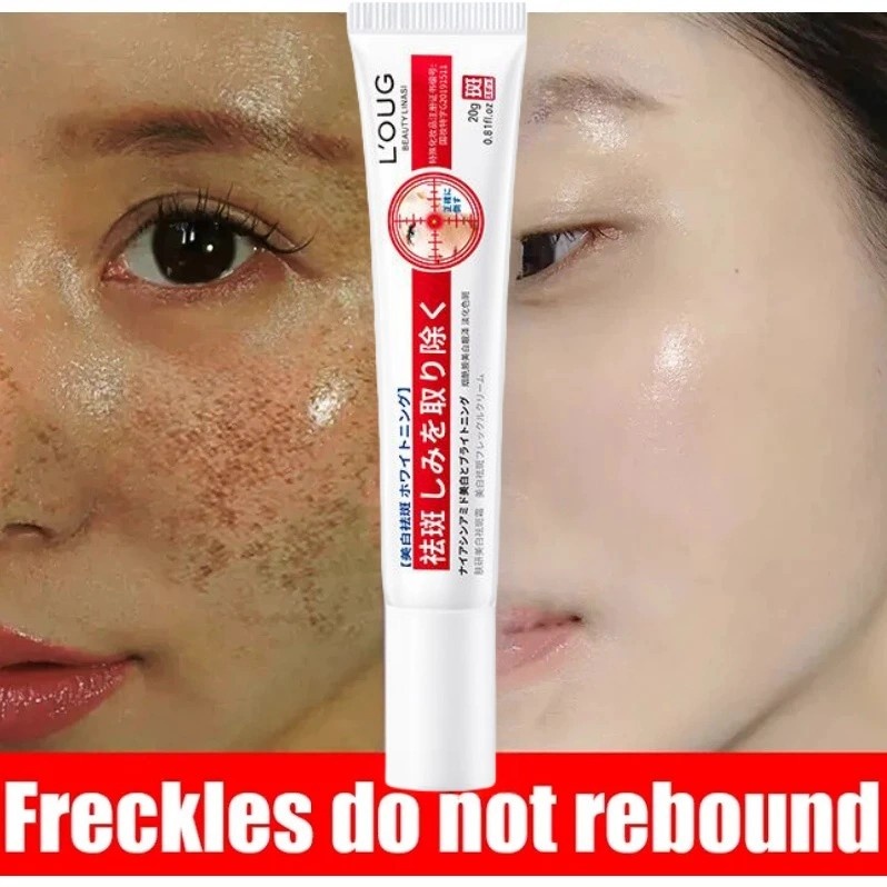 Jual Whitening Freckle Cream Remove Dark Spots Anti Freckle Cream Niacinamide Fade Pigmentation ...