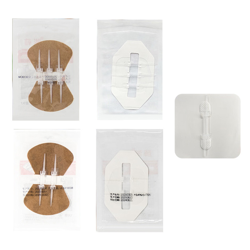 Jual Emergency Wound Closure Zip Stitch Sutures Bandaids Repair Wounds ...