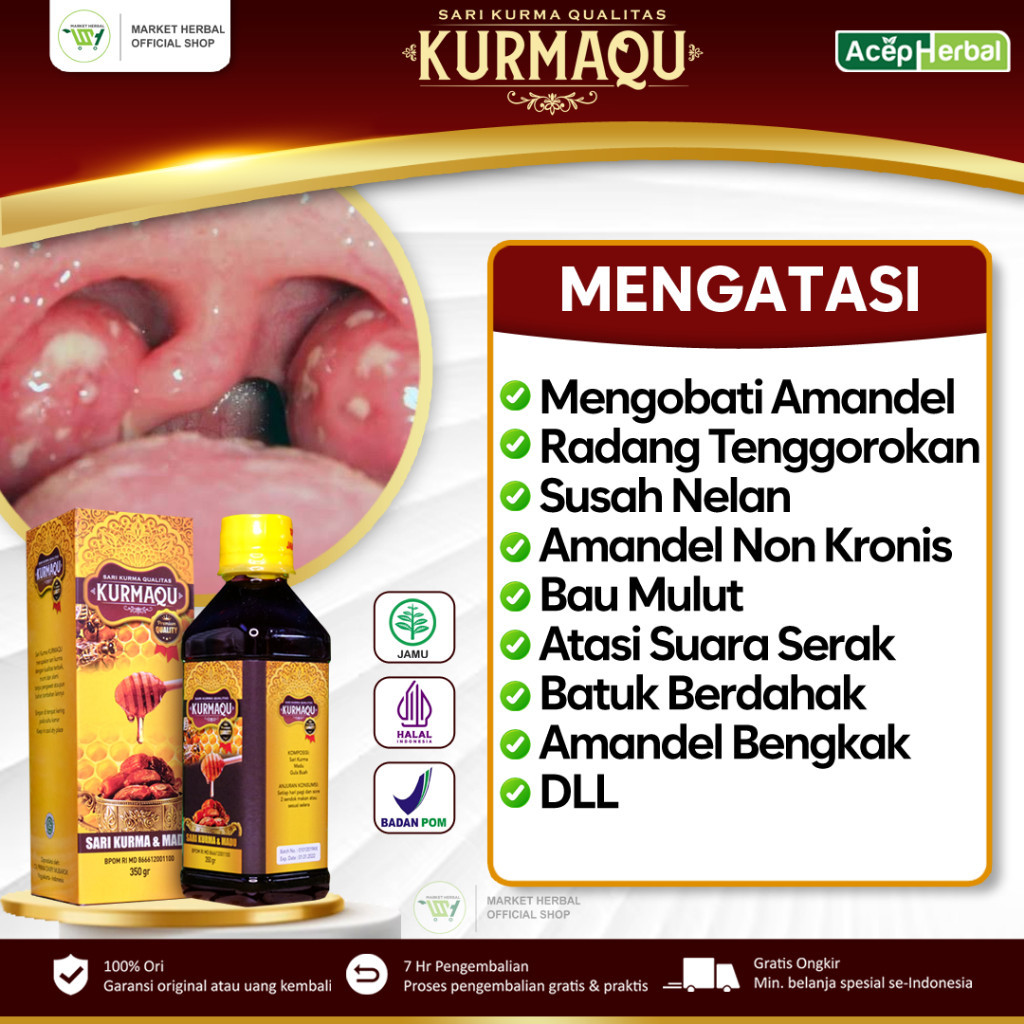 Jual KTM HERBAL Obat Herbal Amandel Anak dan Dewasa Radang Tenggorokan ...