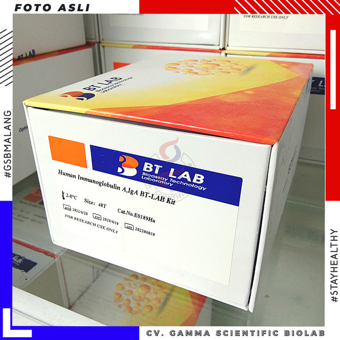 Jual Human Immunoglobulin A, IgA Elisa Kit 48T - BT-LAB | Shopee Indonesia