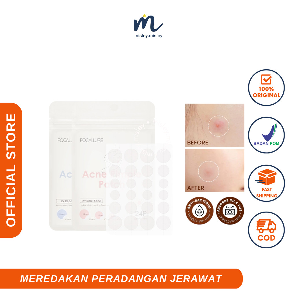 Jual MISLEY - FOCALLURE Spot Patch Acne Treatment Day/Night Original ...