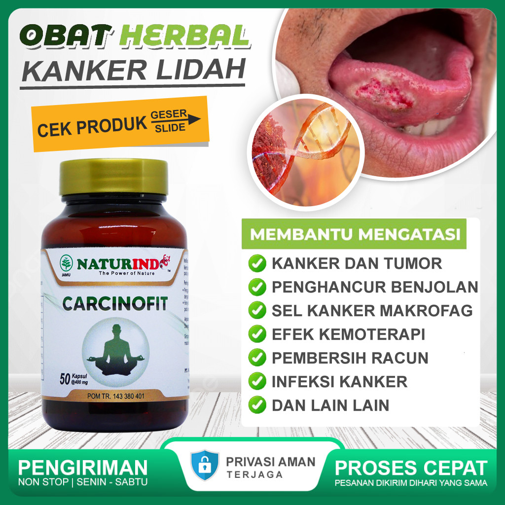 Jual Obat Kanker Lidah Paling Ampuh Tumor Lidah Tanpa Operasi Kangker ...