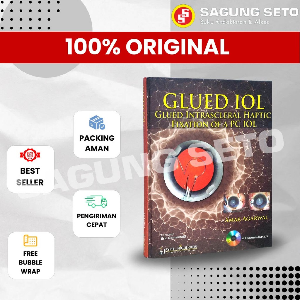 Jual BUKU GLUED IOL GLUED INTRASCLERAL HAPTIC FIXATION OF A PC IOL ...