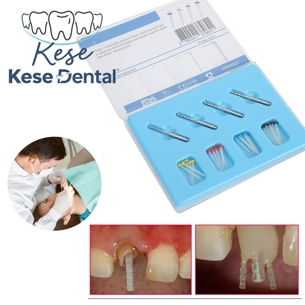 Jual Dental Endo Quartz Fiber Post Straight/Screw Restorative Posts 1.0 ...