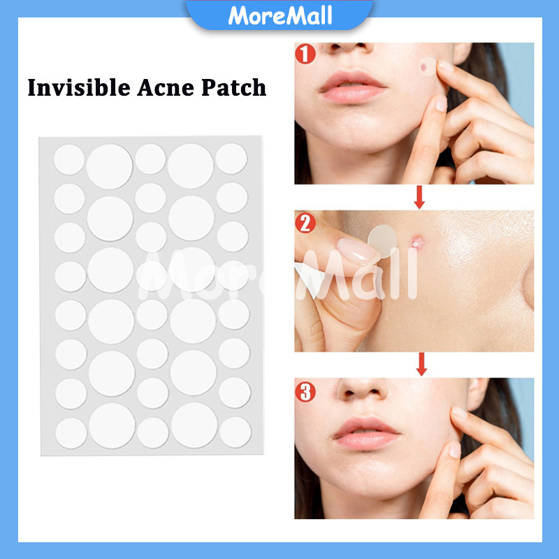 Jual Acne Patch Transparan 36pcs/Sheet /Acne Treatment Sticker | Shopee ...
