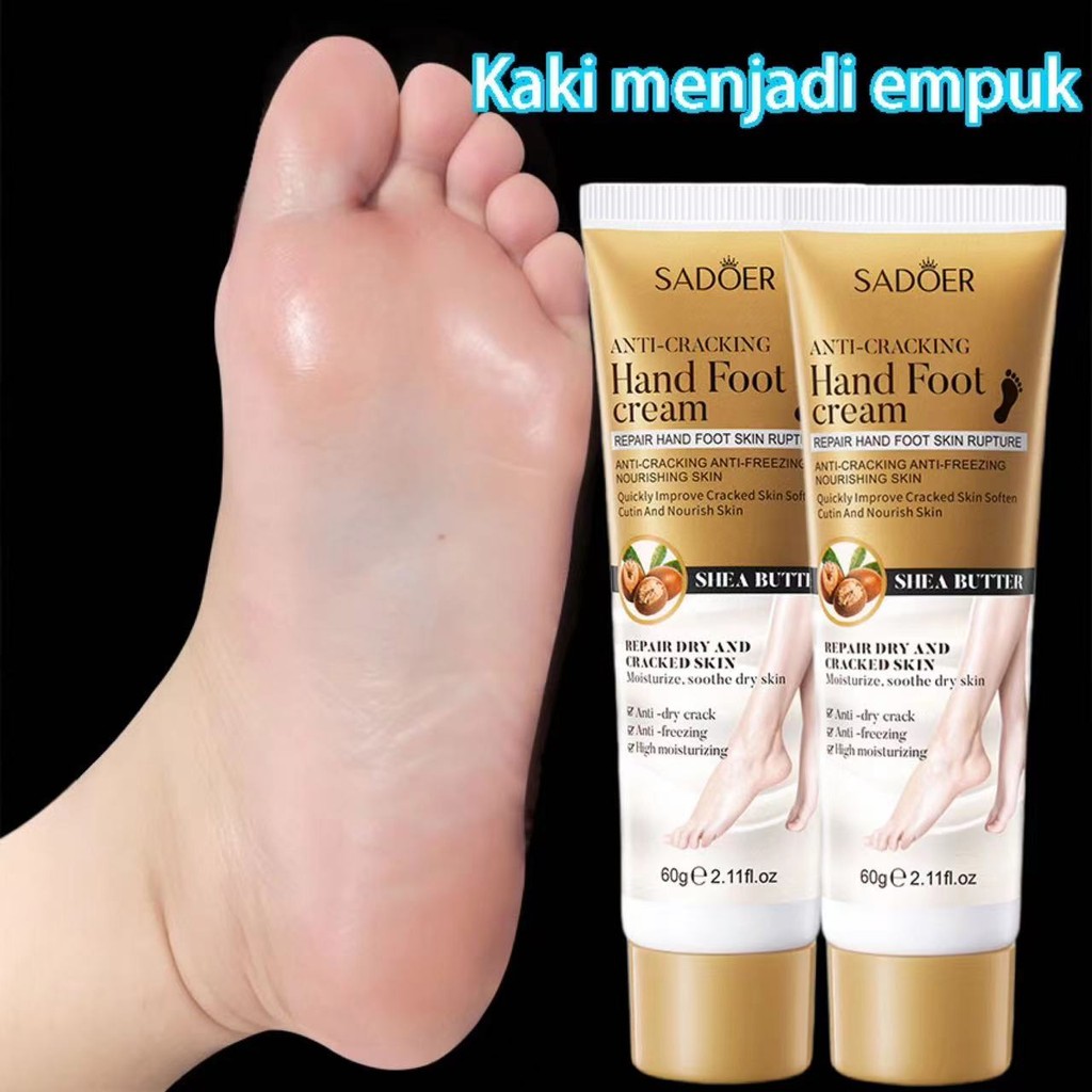 Jual Obat Kaki Pecah Dan Kering Foot Cream Penghalus Tumit Kaki Cream ...