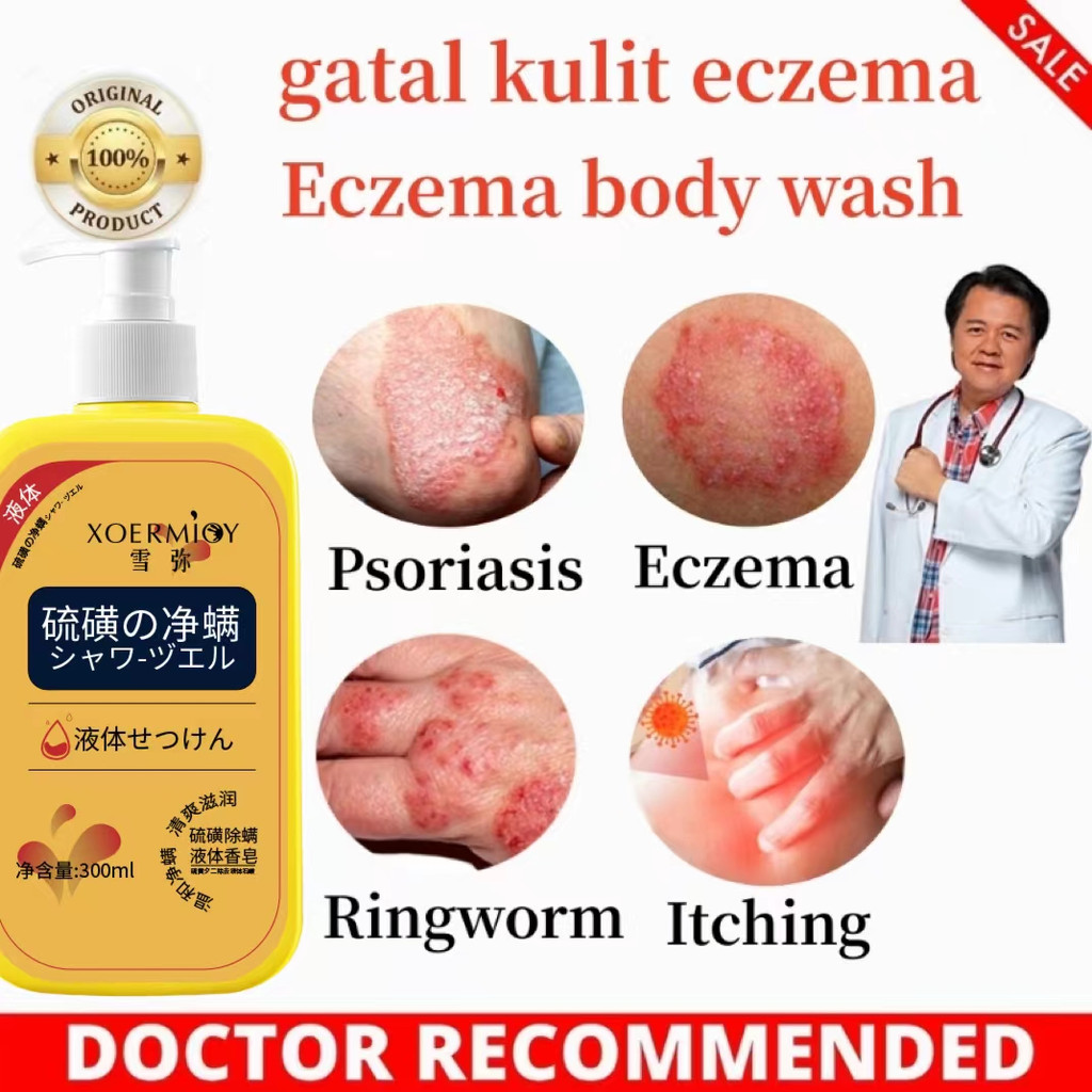 Jual Eczema body wash Obat gatal gatal kulit Pengobatan Eksim Psoriasis ...