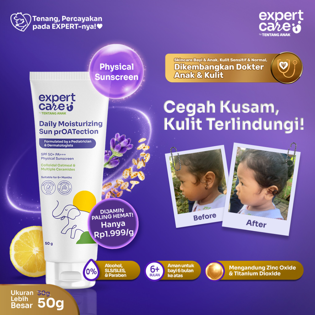 Jual Sunscreen Bayi dan Anak - Expert Care Physical Sunscreen SPF 50 ...