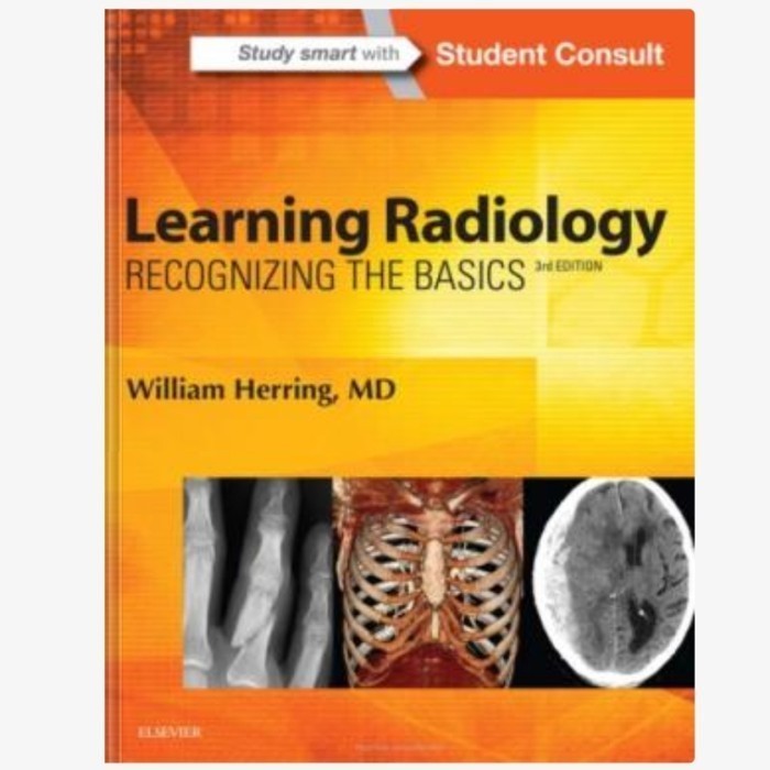 Jual BUKU BUKU Learning Radiology: Recognizing the Basics by William Herring | Shopee Indonesia
