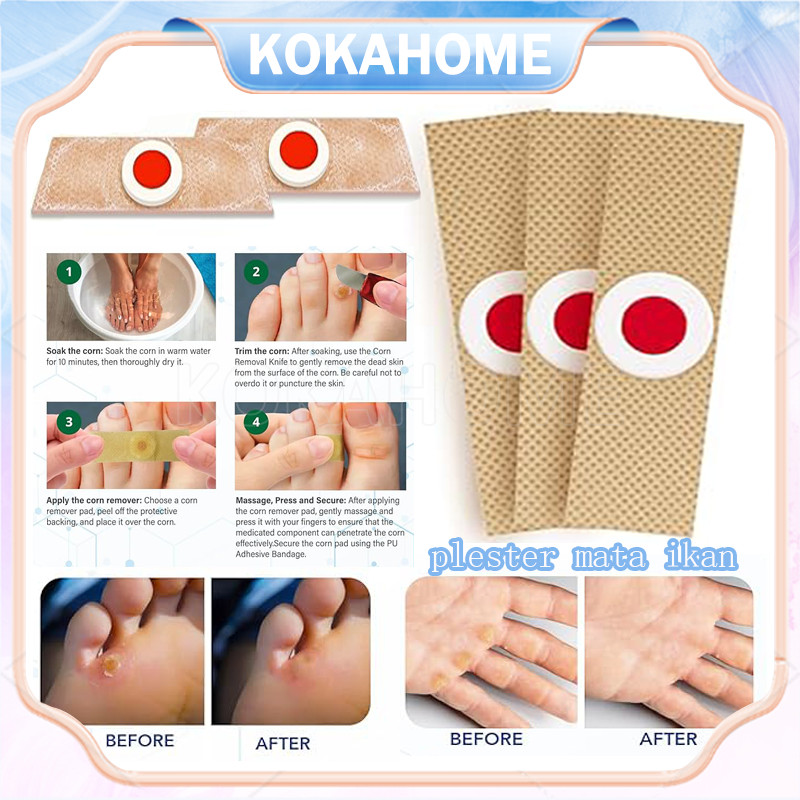 Jual plester mata ikan/plester obat kutil/foot corn removal | Shopee ...