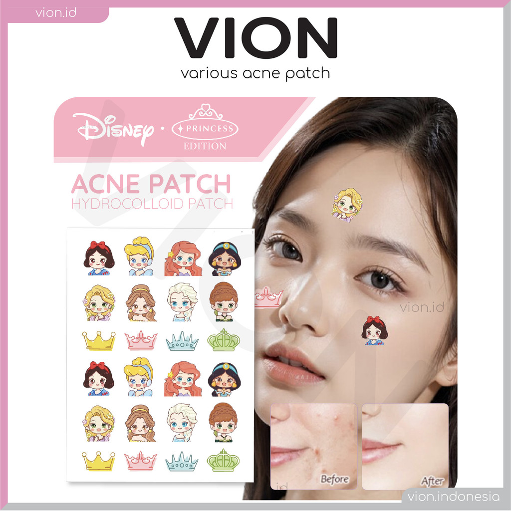 Jual VION Acne Patch Princess Disney Edition Hydrocolloid Penghilang ...