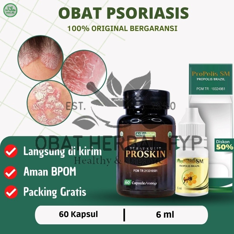 Jual Proskin - Obat Psoriasis, Salep Psoriasis, Obat Psoriasis Kulit ...