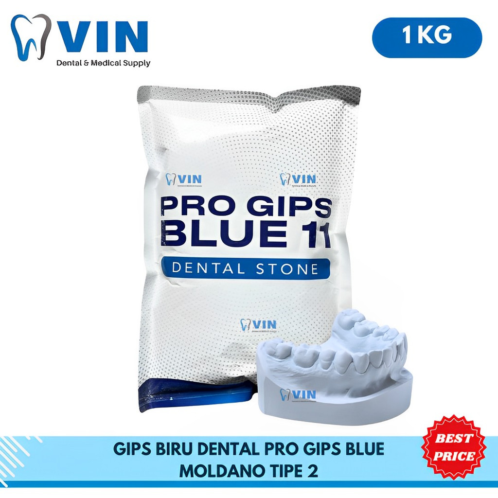 Jual [PGB] Gips biru dental stone moldano tipe 2 pro gips blue gyps gip ...