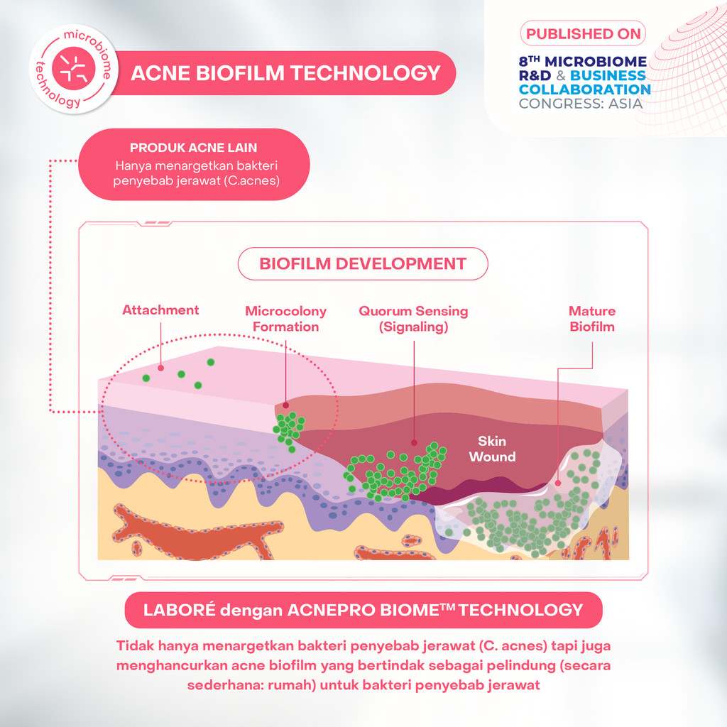Jual LABORÉ Sensitive Skin Care AcnePro Biome Acne Spot Gel 15ml ...