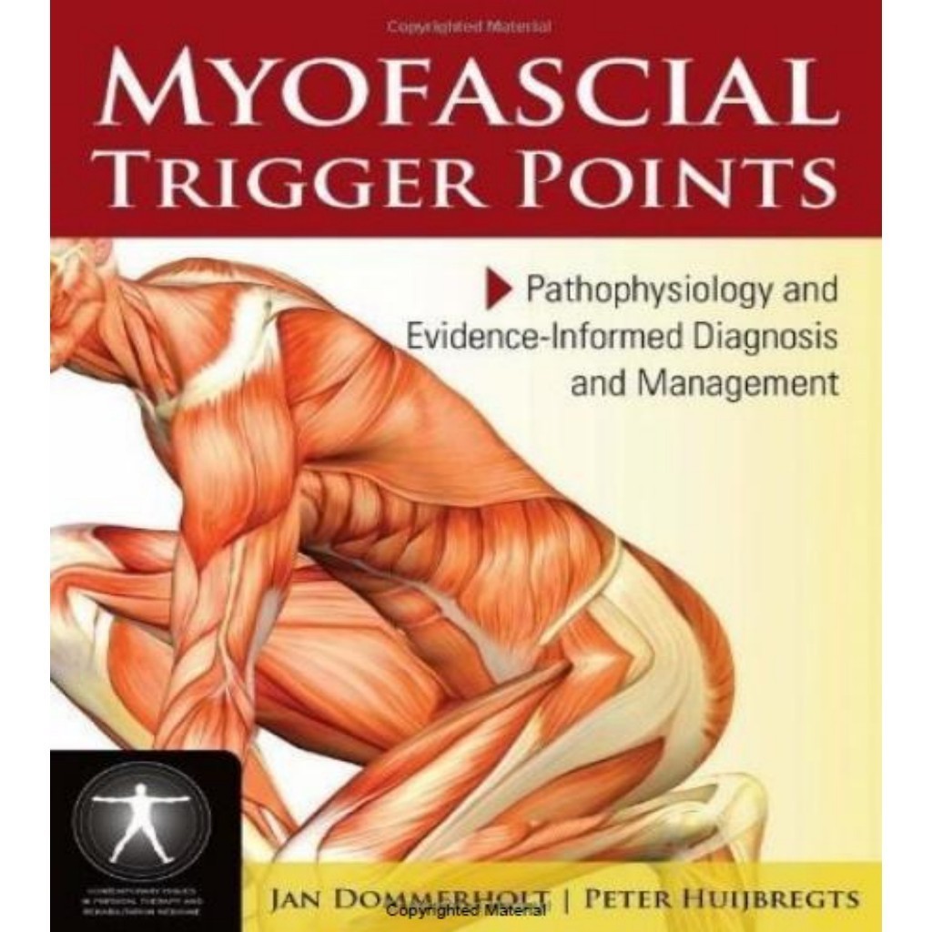 Jual Myofascial Trigger Points Pathophysiology and Evidence-Informed ...