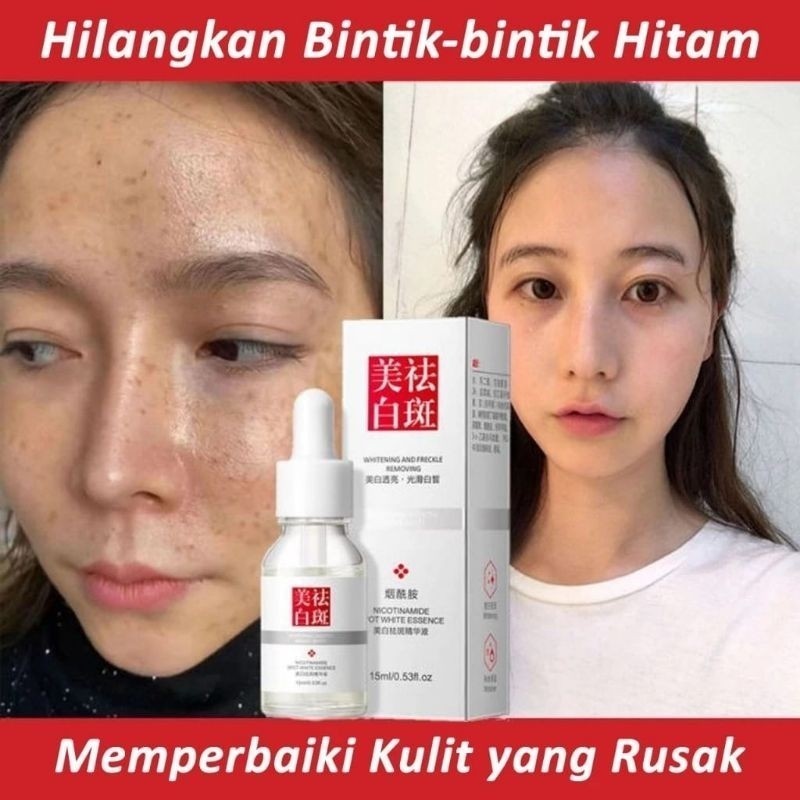 Jual Serum Flek Hitam Fuyan dan Jerawat Whitening Glowing Nicotinamide Bintik Melasma Darkspot ...