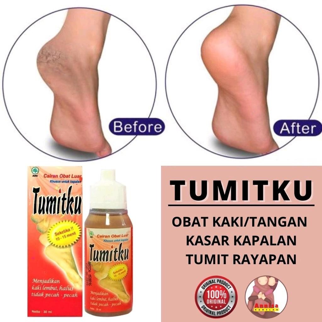 Jual TUMITKU solusi kaki kapalan dan pecah-pecah | Shopee Indonesia