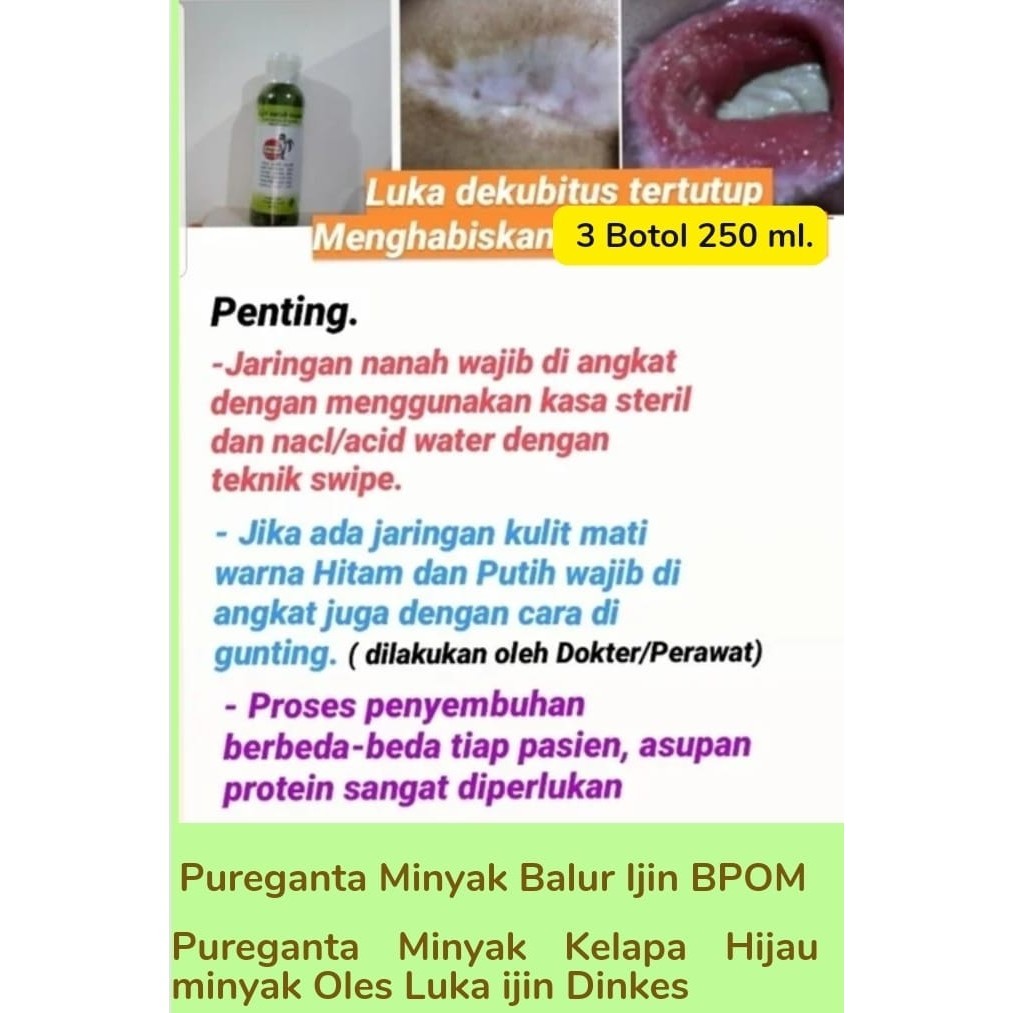 Jual Pureganta - Minyak Oles Ampuh Luka Diabetes kering/Luka Diabetes ... Jual Pureganta - Minyak Oles Ampuh Luka Diabetes kering/Luka Diabetes ...