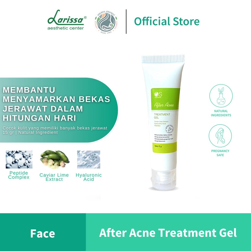 Jual Larissa AFTER ACNE Treatment Gel - Skincare Untuk Memudarkan ...